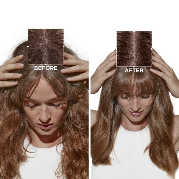 Symbiose - Ny Kerastase-serie mod skæl